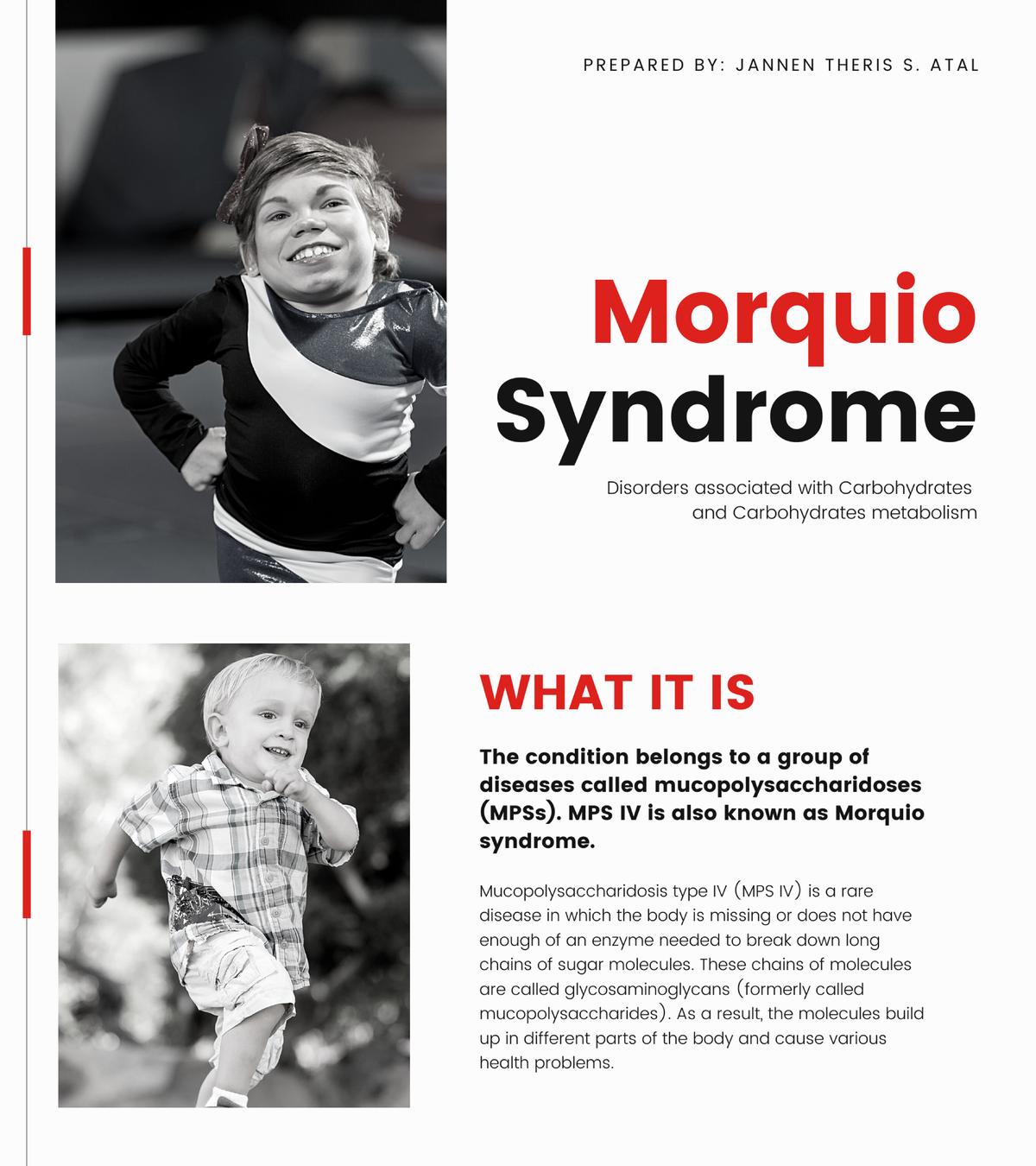 Morquio Syndrome Sumary - BS Psychology - Studocu
