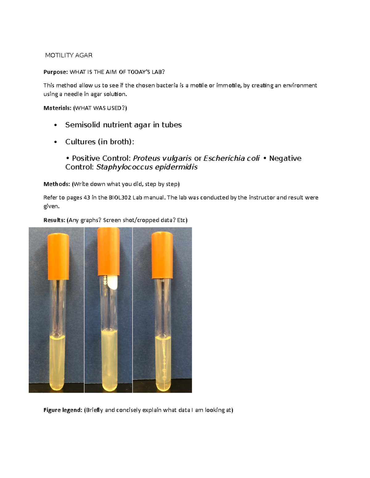 Motility AGAR - This method allow us to see if the chosen bacteria is a ...