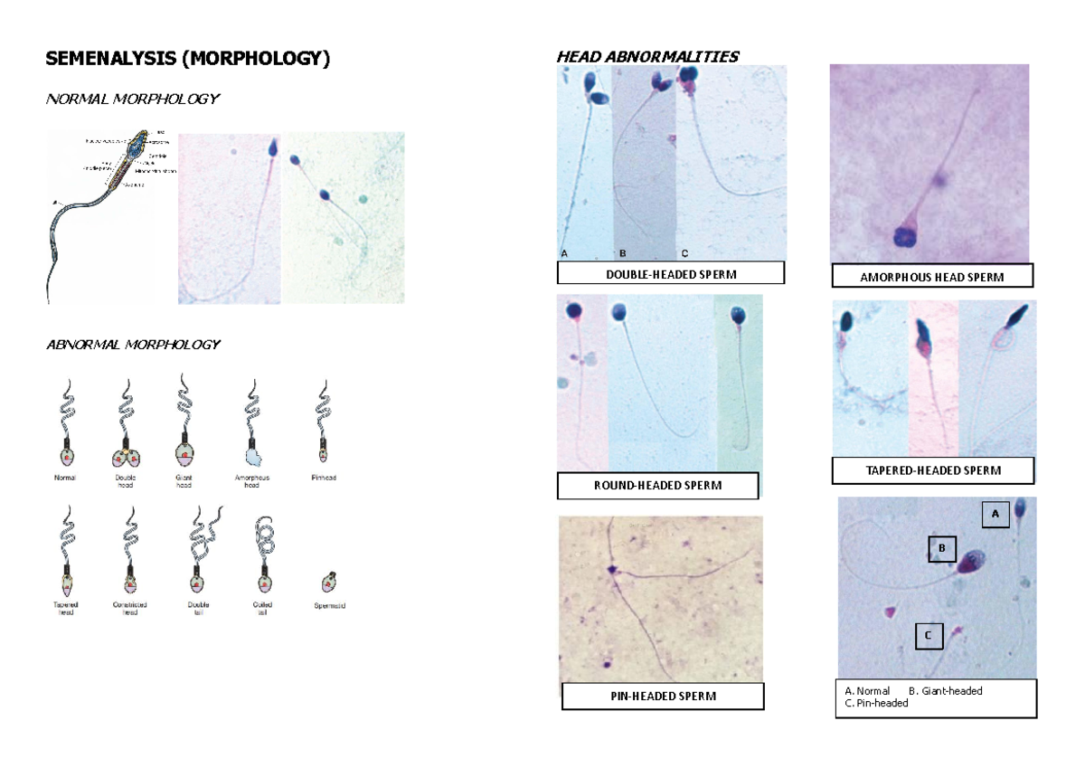 Semenalysis Morpho- Notes - SEMENALYSIS (MORPHOLOGY) NORMAL MORPHOLOGY ...