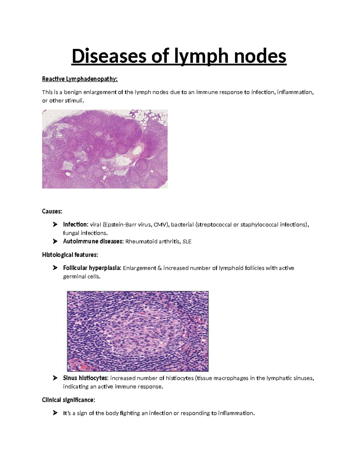 Diseases of lymph nodes - Diseases of lymph nodes Reactive ...