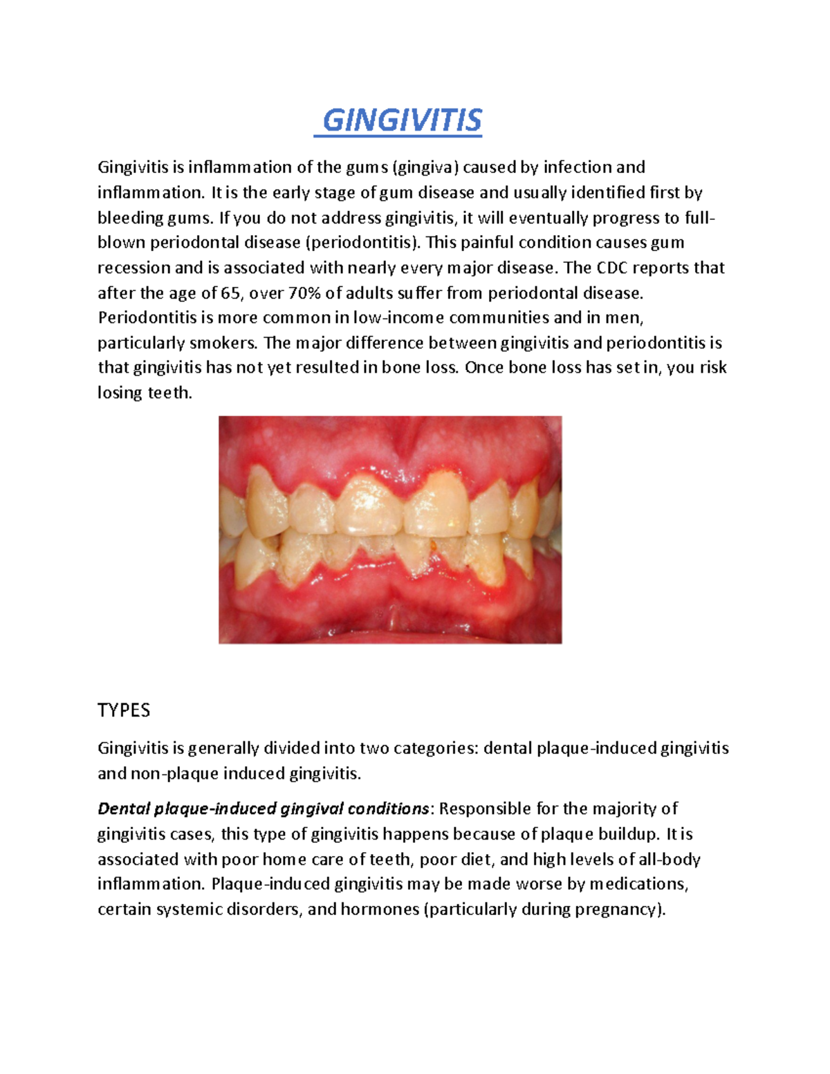 Gingivitis - Bachelor of dental science - RGUHS - Studocu