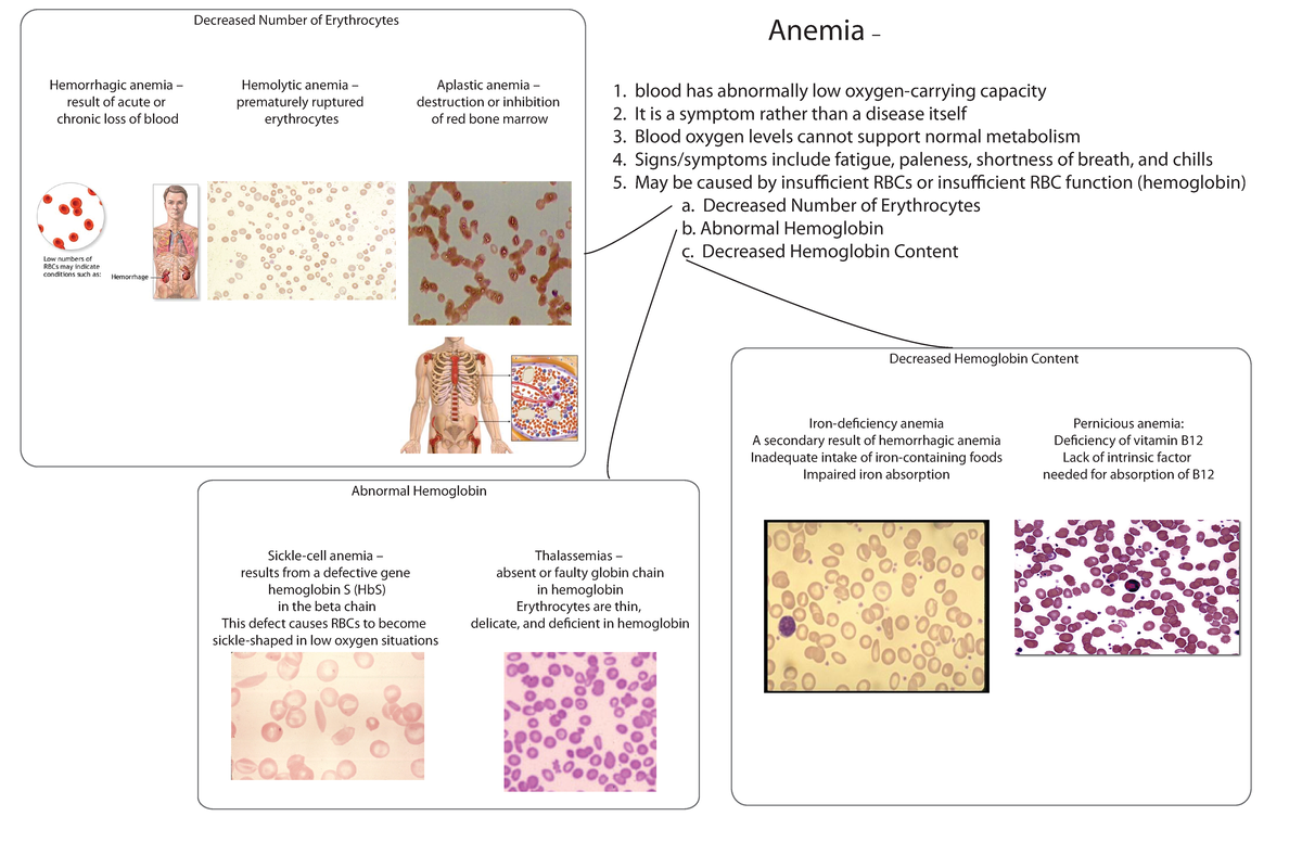 Blood d with anemiasb - Decreased Number of Erythrocytes Hemorrhagic ...