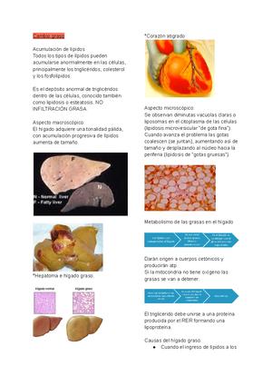 Muerte somatica - La muerte es el cese irreversible de funciones ...