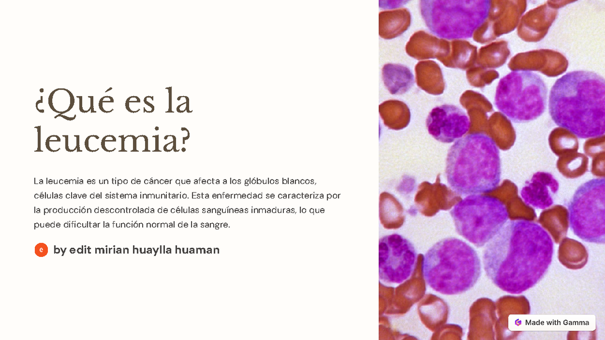 Que es la leucemia - ¿Qué es la leucemia? La leucemia es un tipo de ...