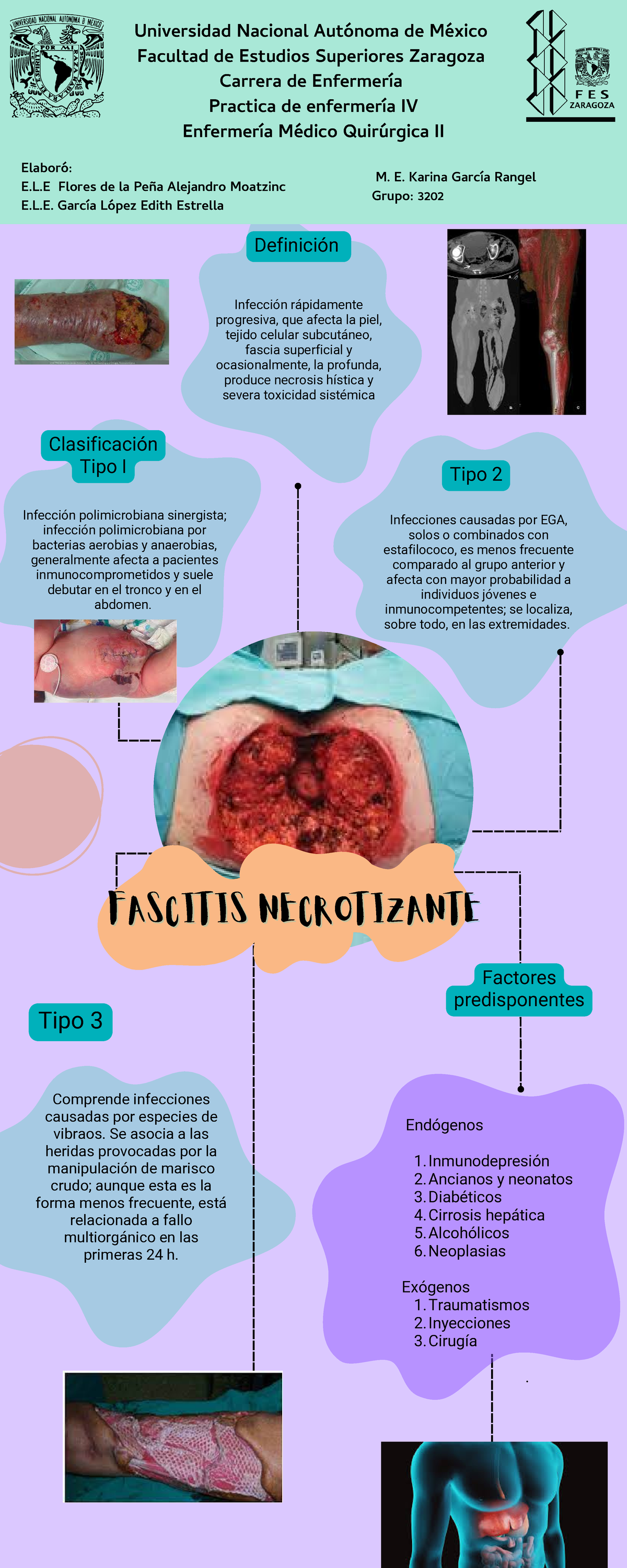 Fascitis Necrotizantes - Universidad Nacional Autónoma de México ...