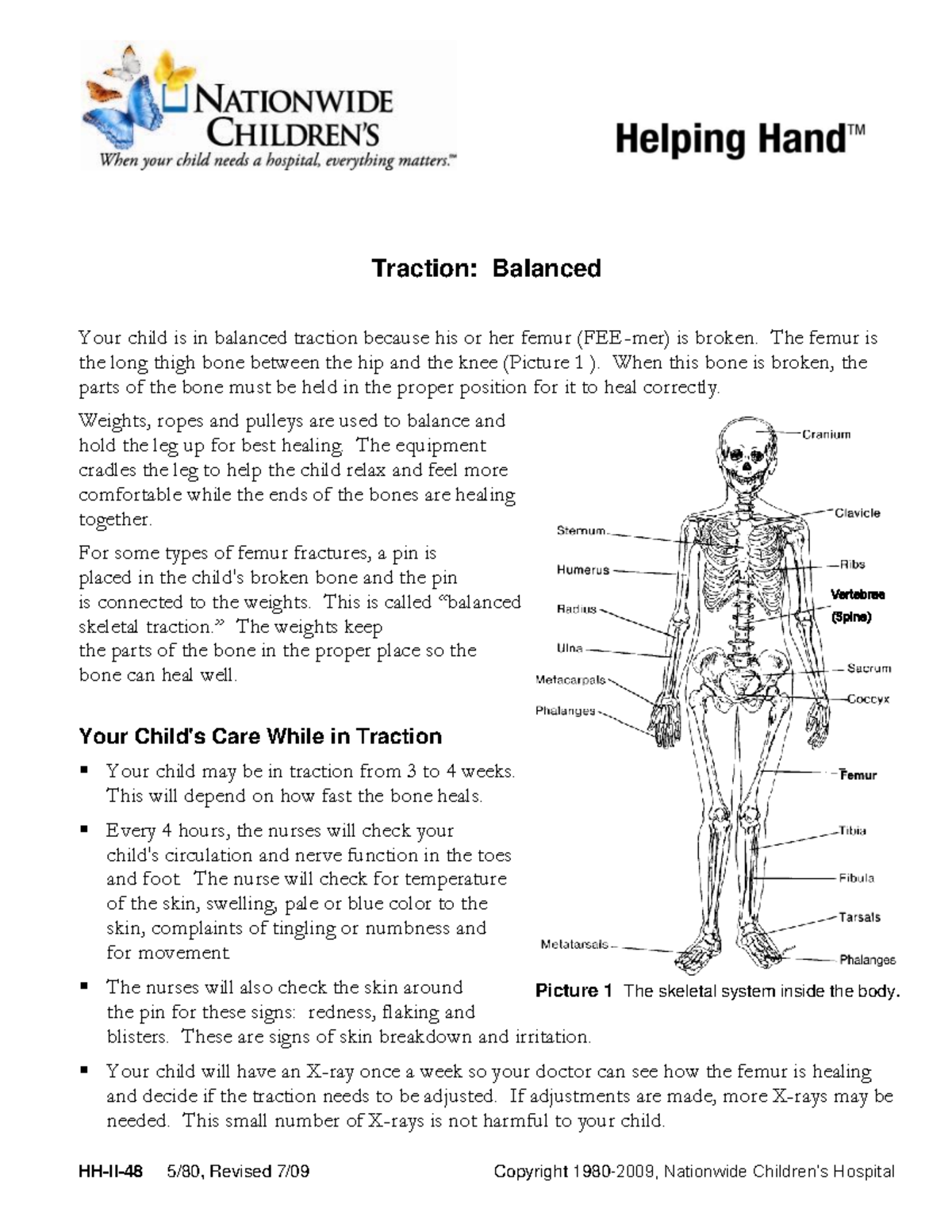 Nurs 1 - good - Traction: Balanced Your child is in balanced traction ...