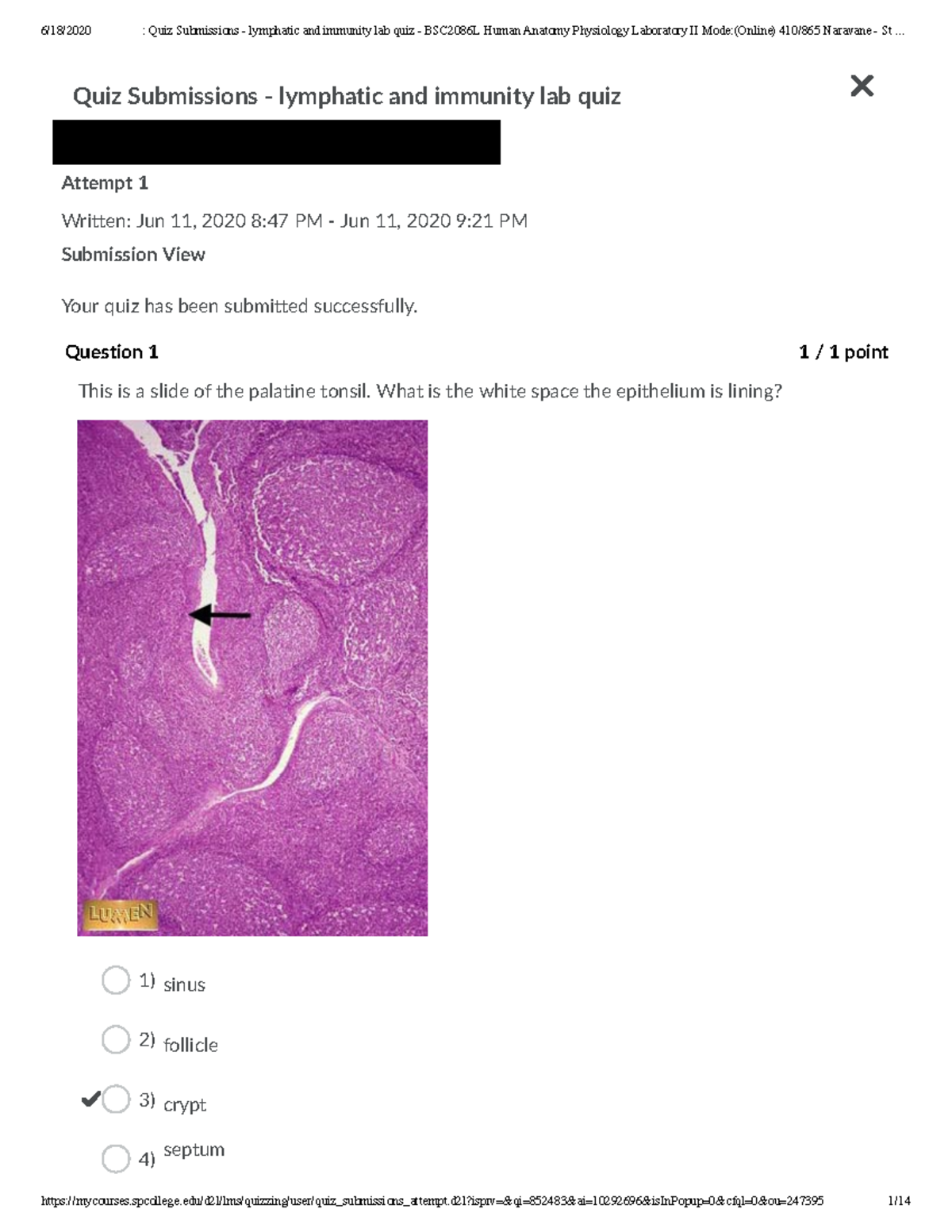 Quiz Submissions lymphatic and immunity lab quiz BSC2086L Human Anatomy ...