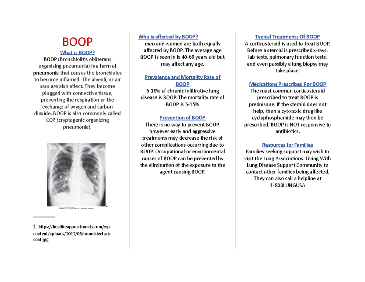 SPAA 161 Brochure - BOOP What is BOOP? BOOP (Bronchiolitis obliterans ...