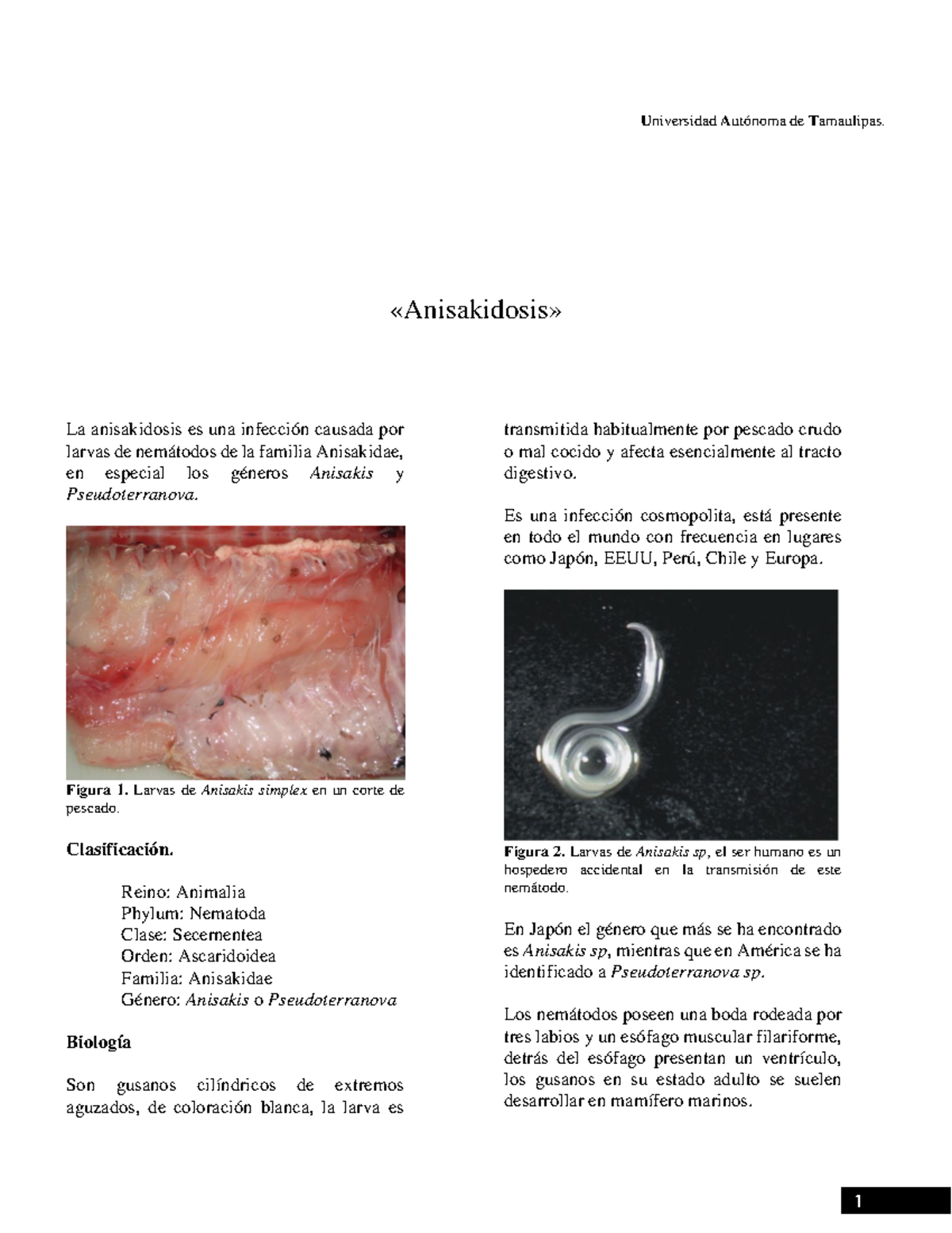 Anisakidosis - Universidad Autónoma de Tamaulipas. «Anisakidosis» La ...