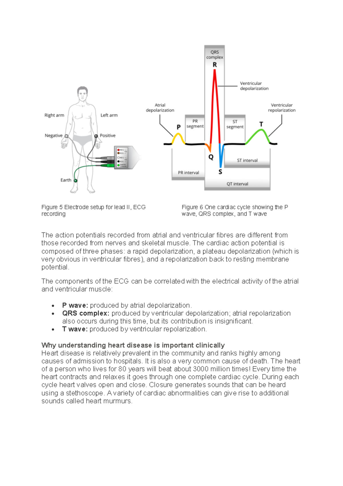 ECG - ECG - Figure 5 Electrode setup for lead II, ECG recording Figure ...