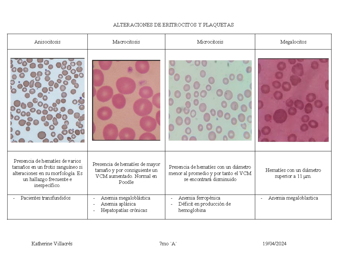 Alteraciones en eritrocitos y plaquetas - Anisocitosis Macrocitosis ...
