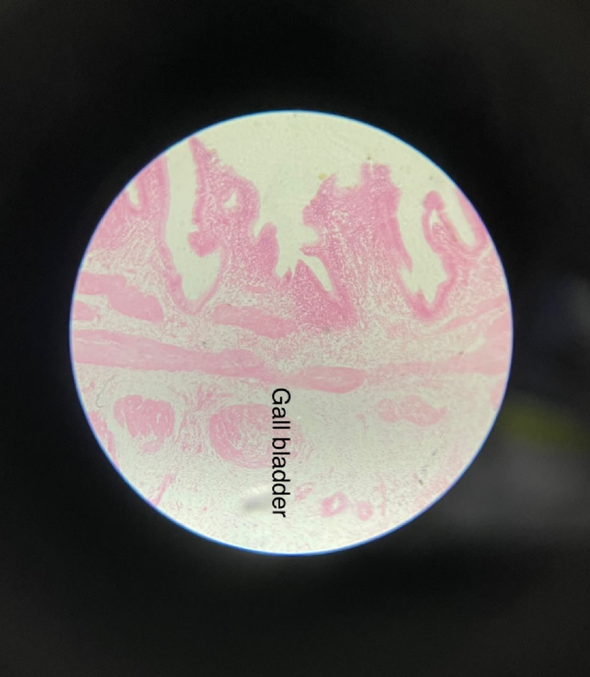 Histology slides - Medical science - Gall bladder Gall bladder Duodenum Duodenum Lymph node ...