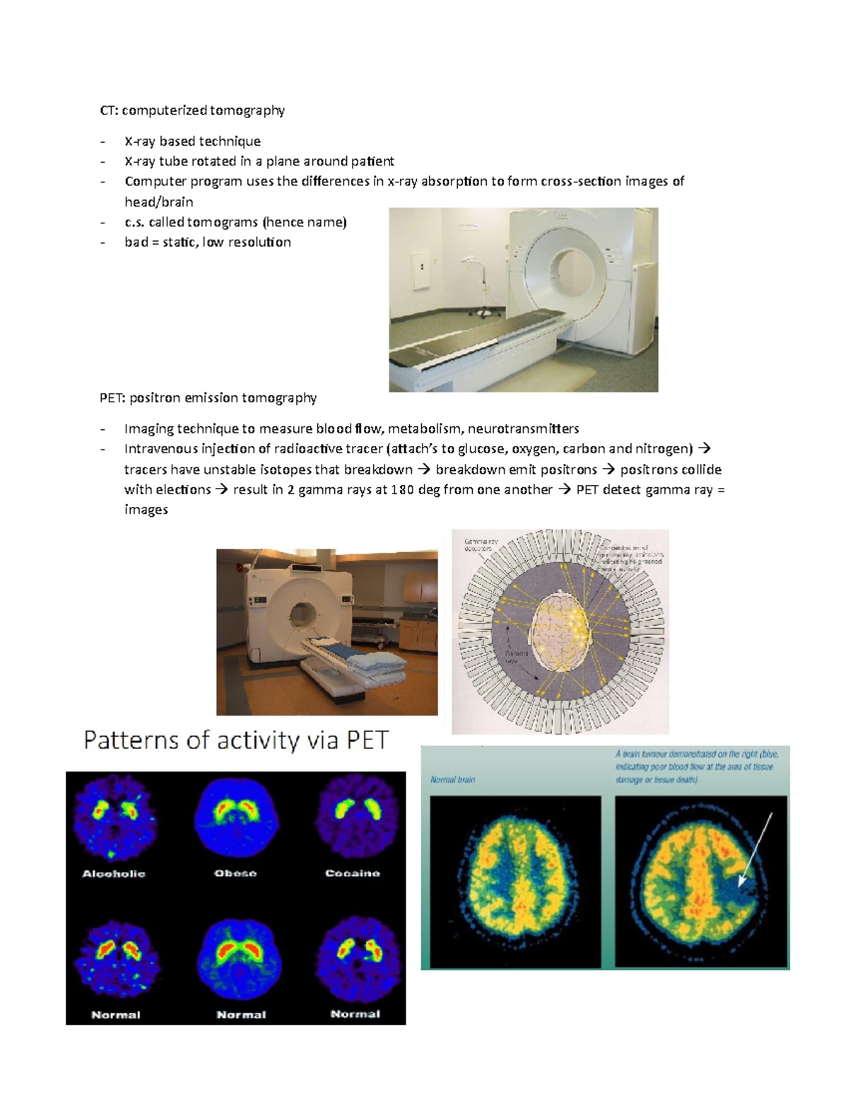 Brain and behaviour Lab 4 - CT: computerized tomography X-ray based ...