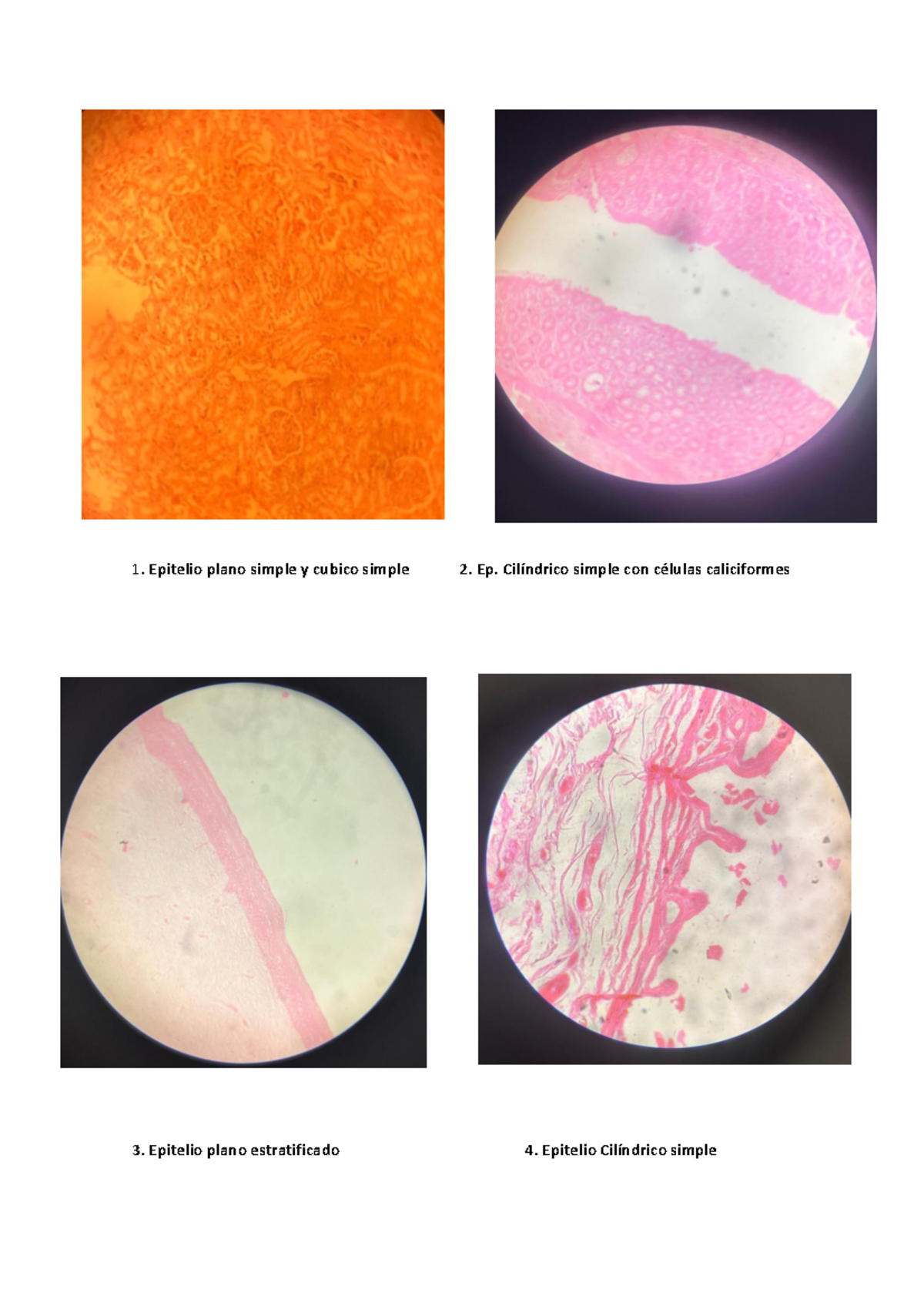 Microscopio 1111 - Epitelio plano simple y cubico simple 2. Ep ...
