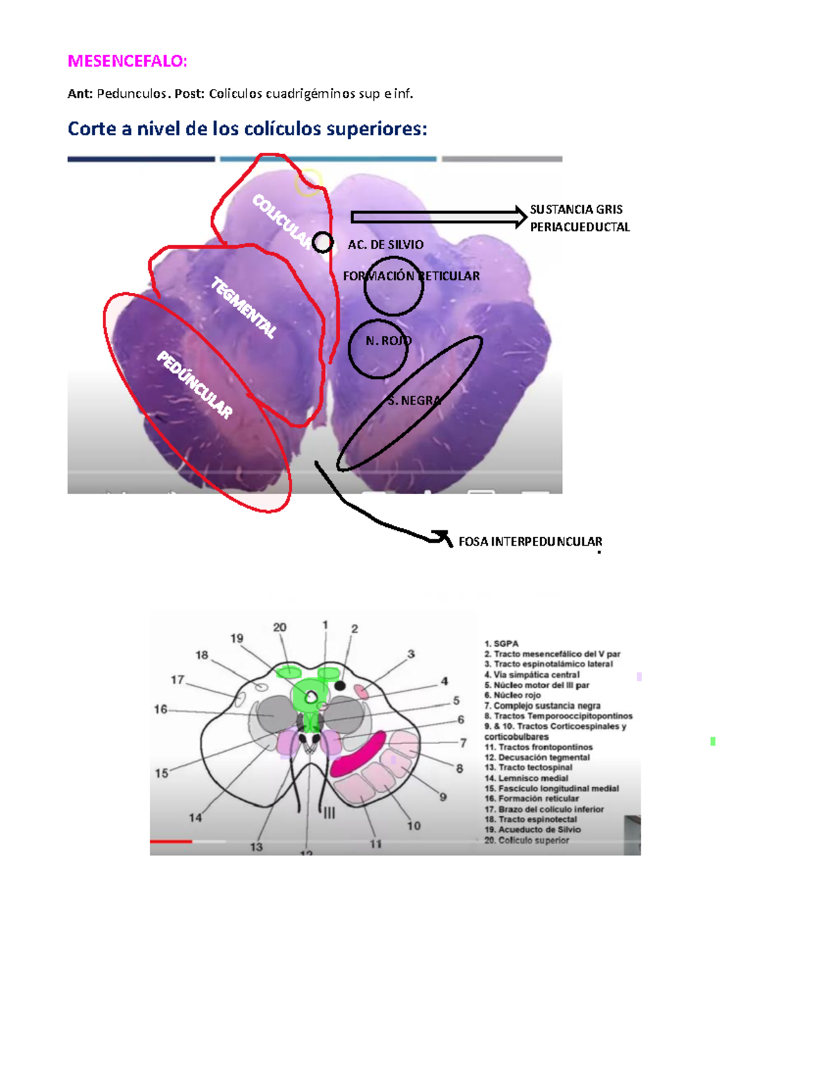 Mesencefalo - MESENCEFALO: Ant: Pedunculos. Post: Coliculos ...
