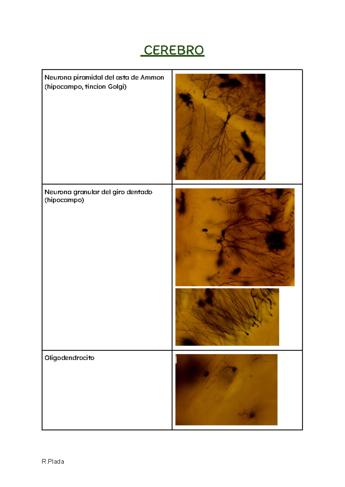 Histo NCR Imagenes Microscopio - CER Neurona piramidal del asta de ...