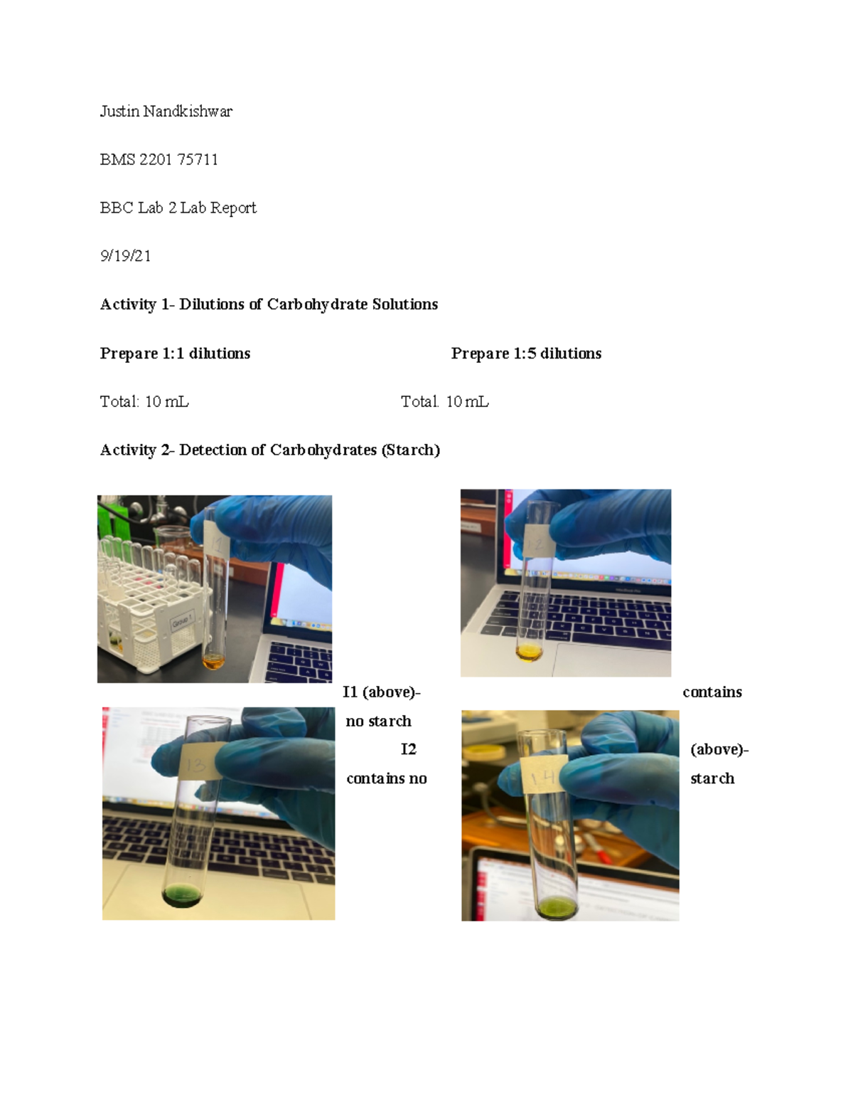 BMS 2201 Lab 2 Report - lecture - Justin Nandkishwar BMS 2201 75711 BBC Lab 2 Lab Report 9/19 ...