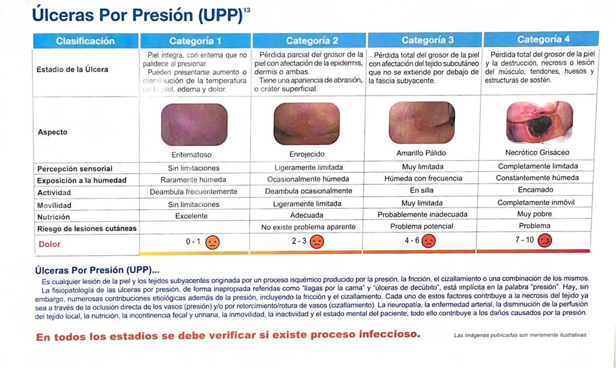 Úlceras por presión - Repaso - Úlceras Por Presión (UPP)¹ Clasificación Categoría 1 Categoría 2 ...
