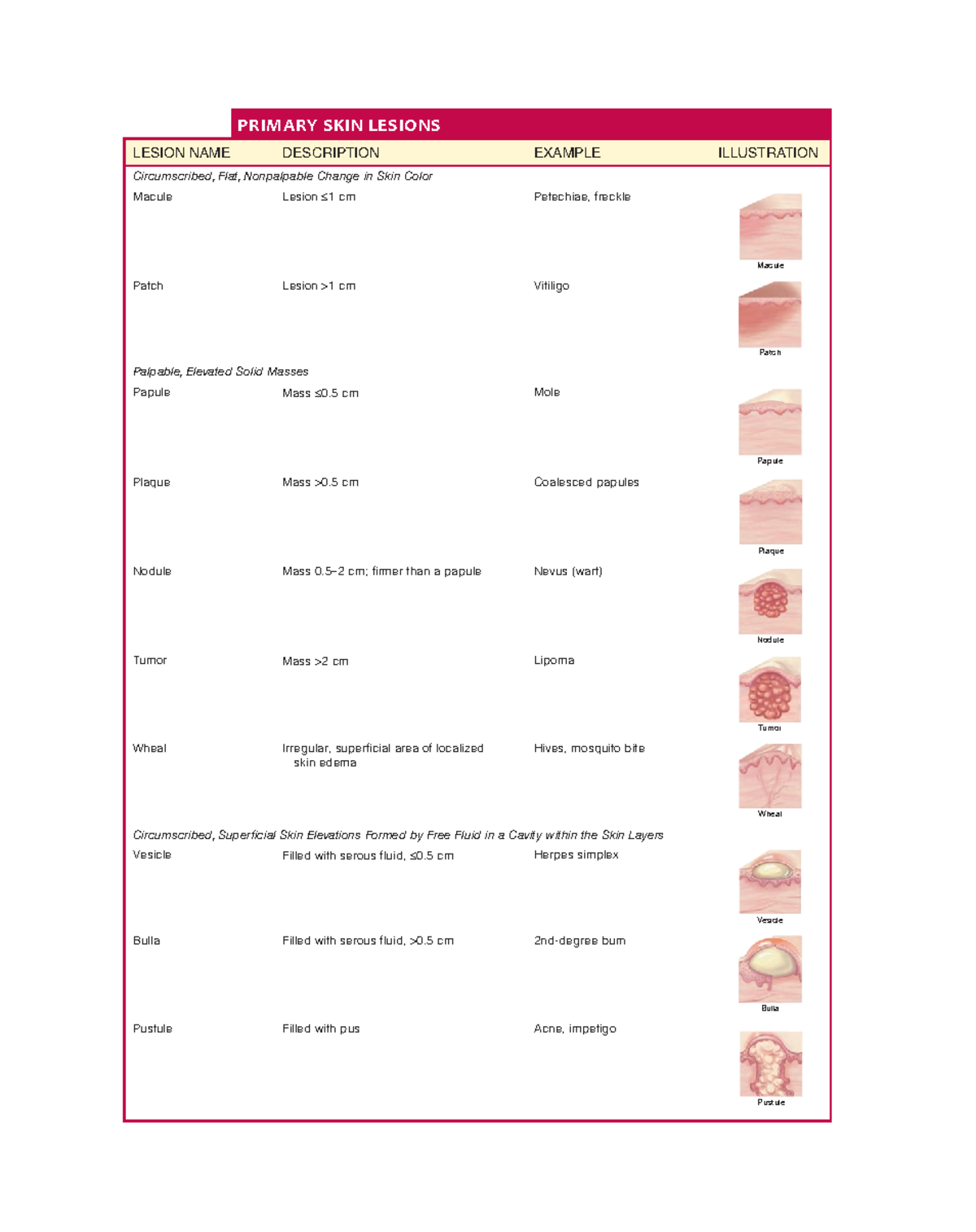 Primary and Secondary Skin Lesions - Primary PRIMARY Skin lesions ...