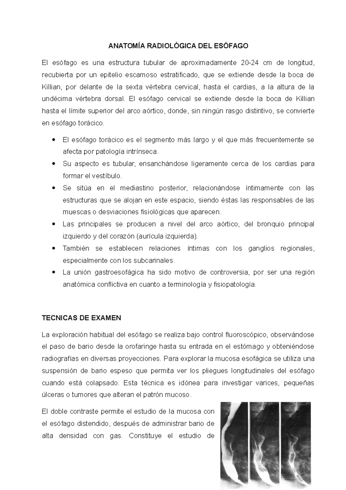 Infografia Esofagograma - Indicada para el estudio del sistema ...