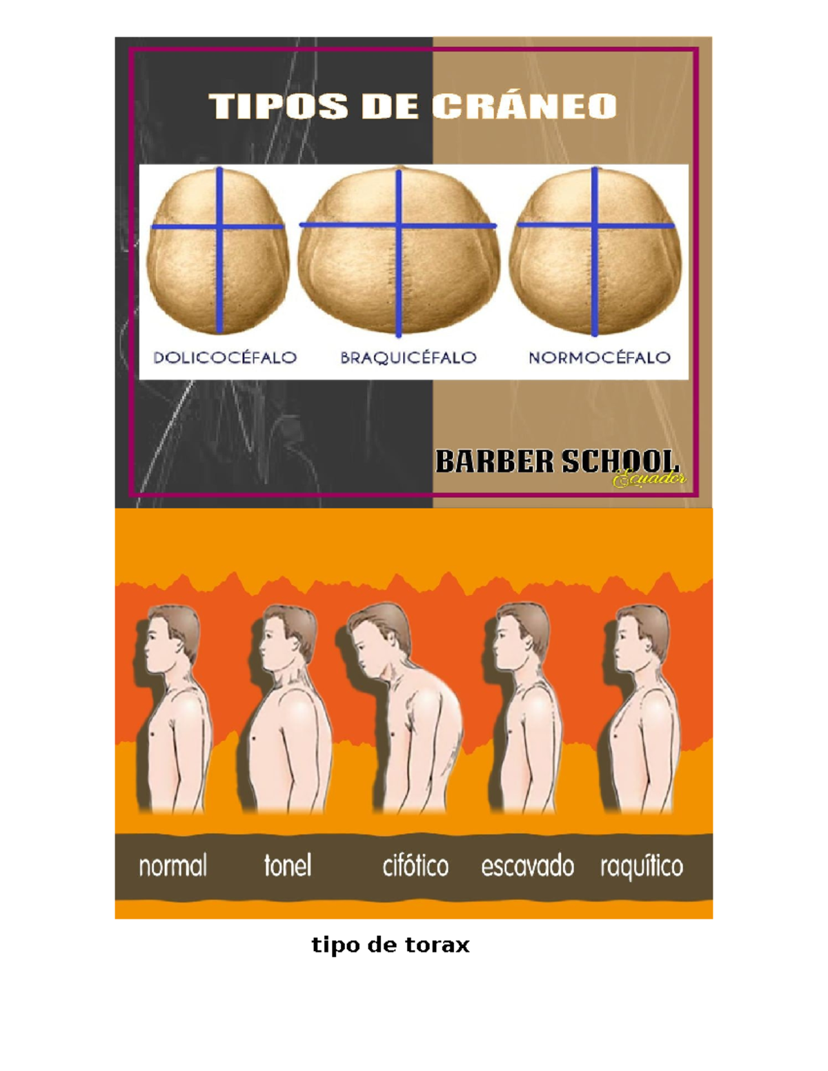 Tipos y clasificaciones - TIPOS DE CRÁNEO DOLICOCÉFALO BRAQUICÉFALO ...