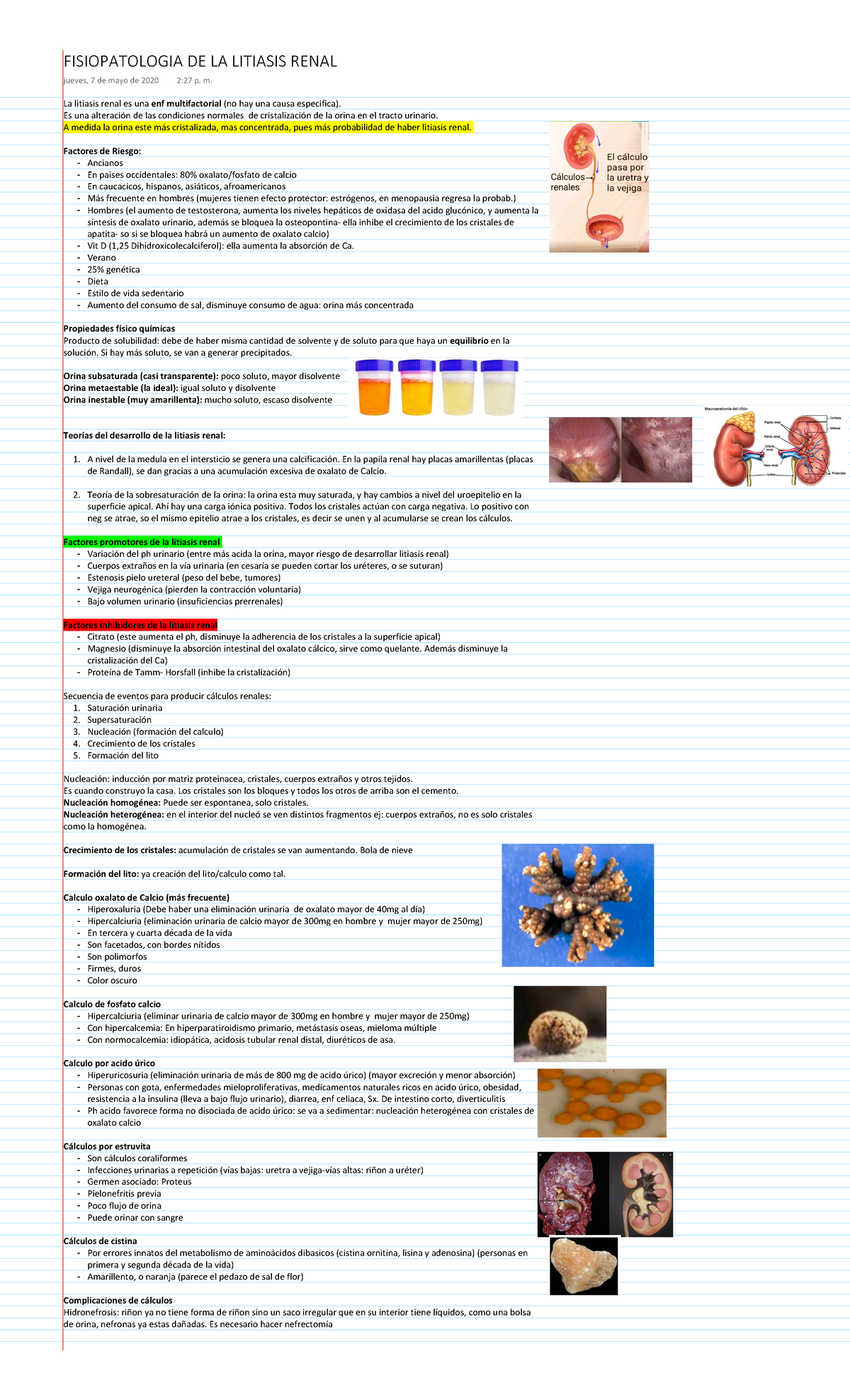 Fisiopatologia de la Litiasis Renal - Warning: TT: undefined function: 32 - Studocu
