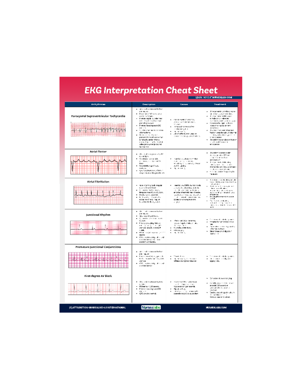 EKG-Interpretation-Cheat-Sheet-for-Heart-Arrhythmias Nurseslabs 2 ...