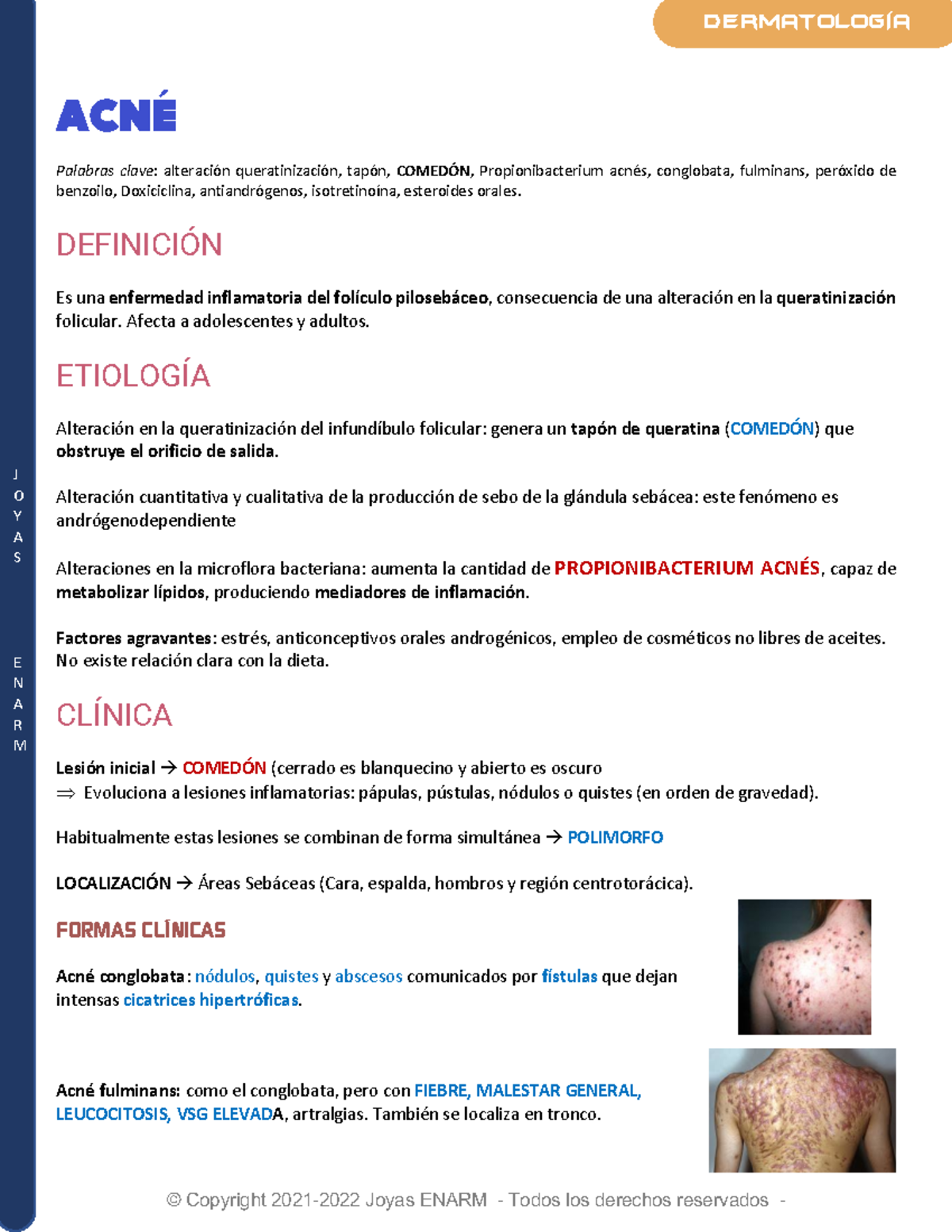 6. Acné - Resumen Dermatología - © Copyright 2021-2022 Joyas ENARM ...
