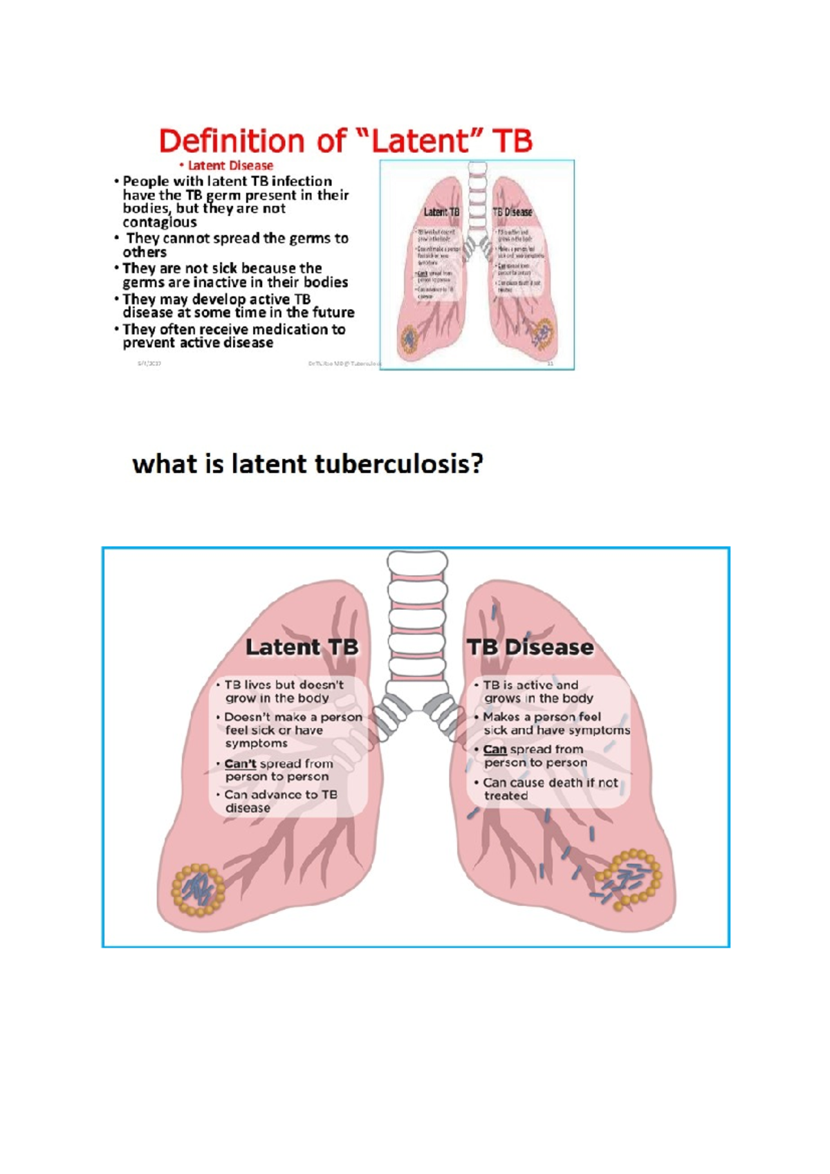 TB - TB notes - Medicine - Studocu