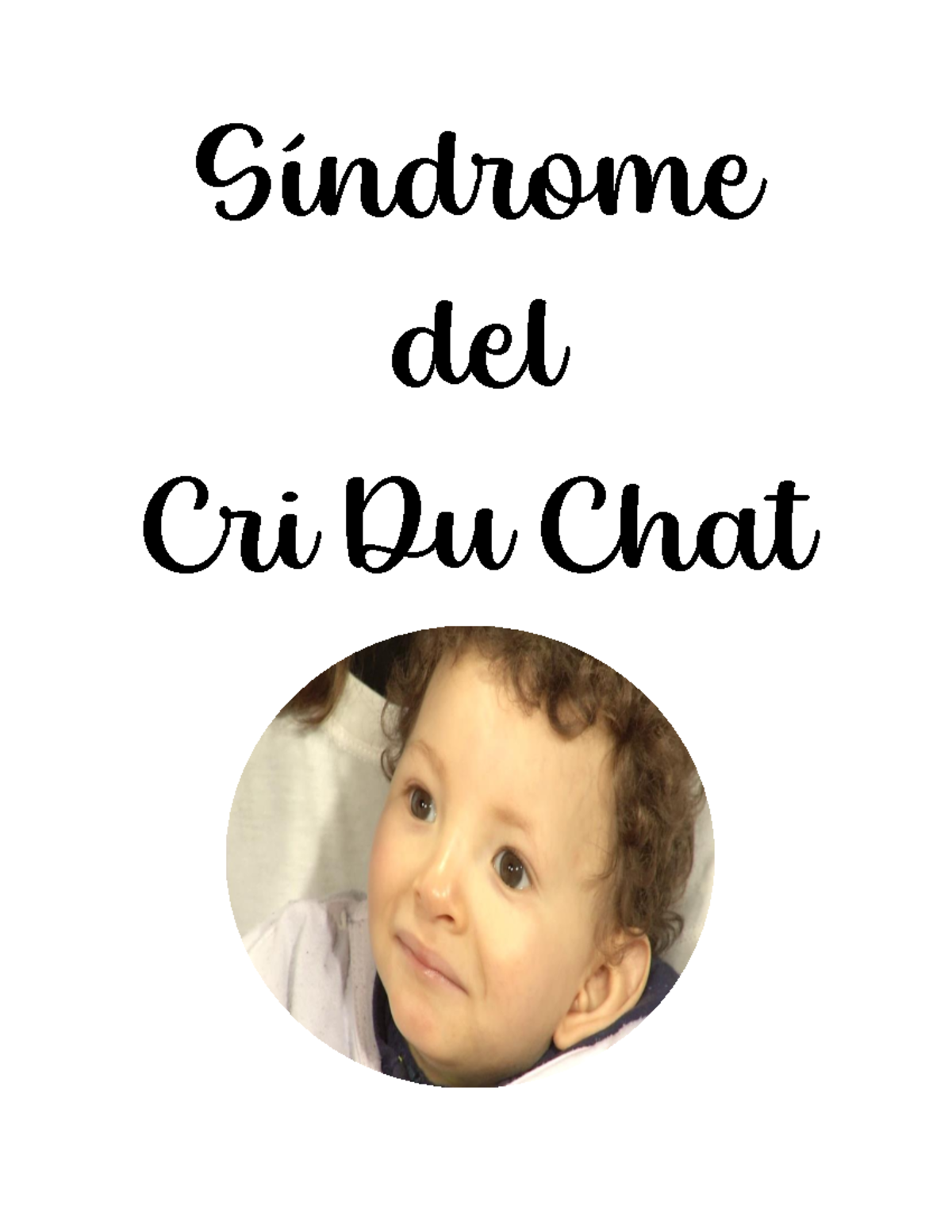 Sindromes - Sindrome de CRI DU CHAT entre otros - Síndrome del Cri Du ...