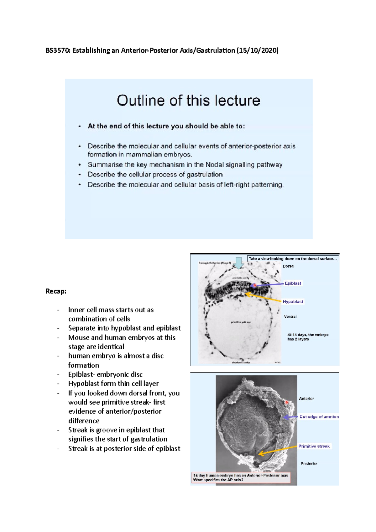 Establishing AP Axis: Gastrulation - BS3570: Establishing an Anterior ...