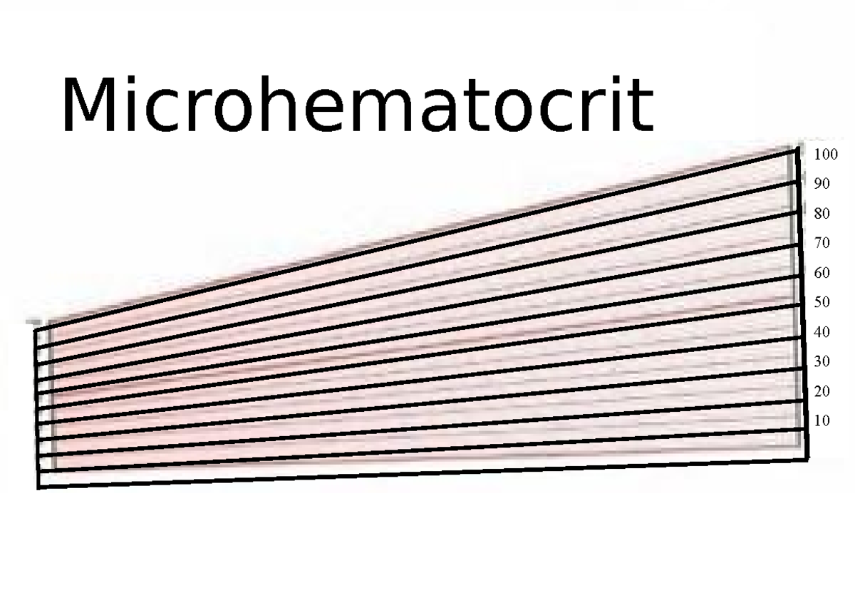 Microhematocritotehteeteherh kwldfjoqpewf - Citología y histología ...