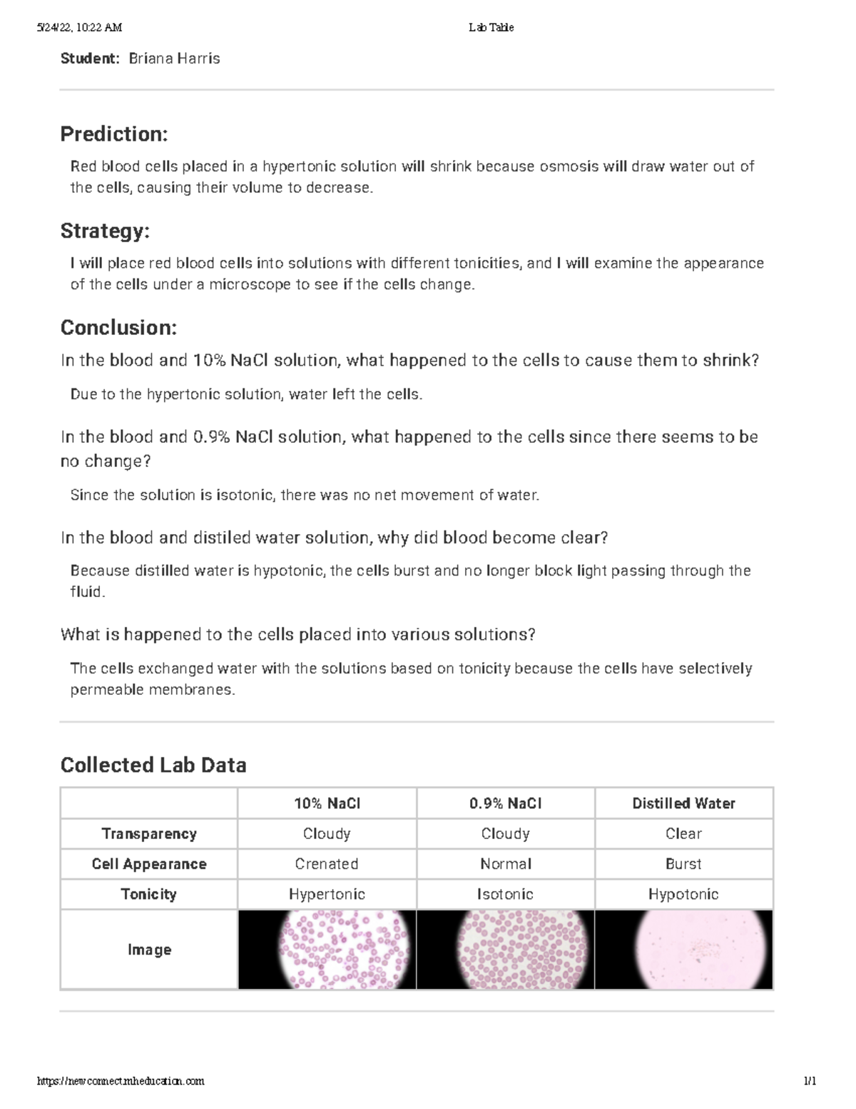 Lab 04 Part 6 - Osmosis - Tonicity in Red Blood Cells - 5/24/22, 10:22 ...