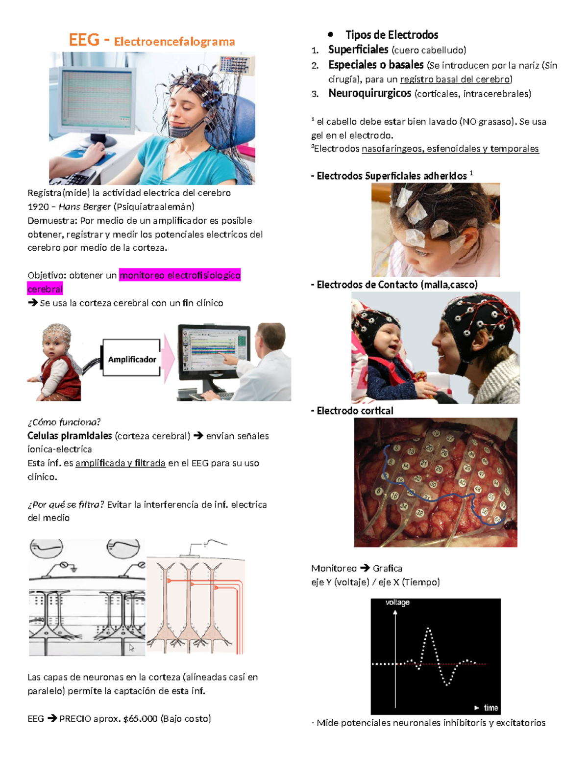13. Actividad Eléctrica Cerebral-EEG - EEG - Electroencefalograma ...