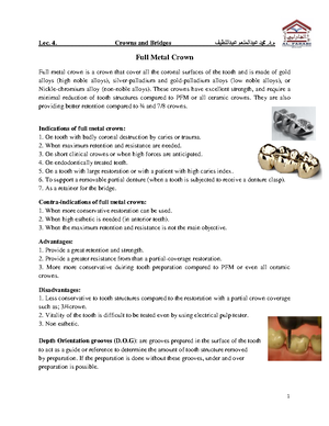 Crown - Bridge Lec - Fixed Prosthodontics - Lec. 8. Crowns and Bridges ...