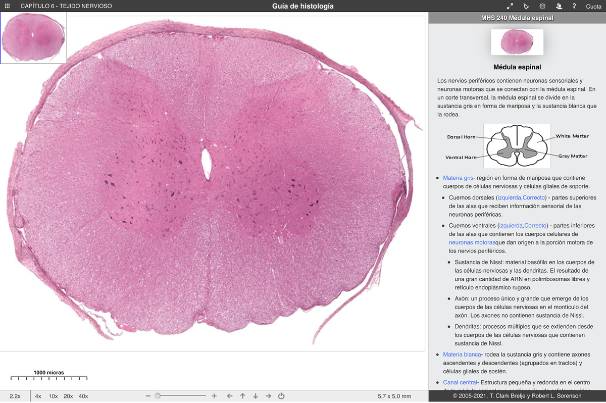 Médula espinal Tejido nervioso 3 - 1000 micras Guía de histología ... Médula espinal Tejido nervioso 3 - 1000 micras Guía de histología ...