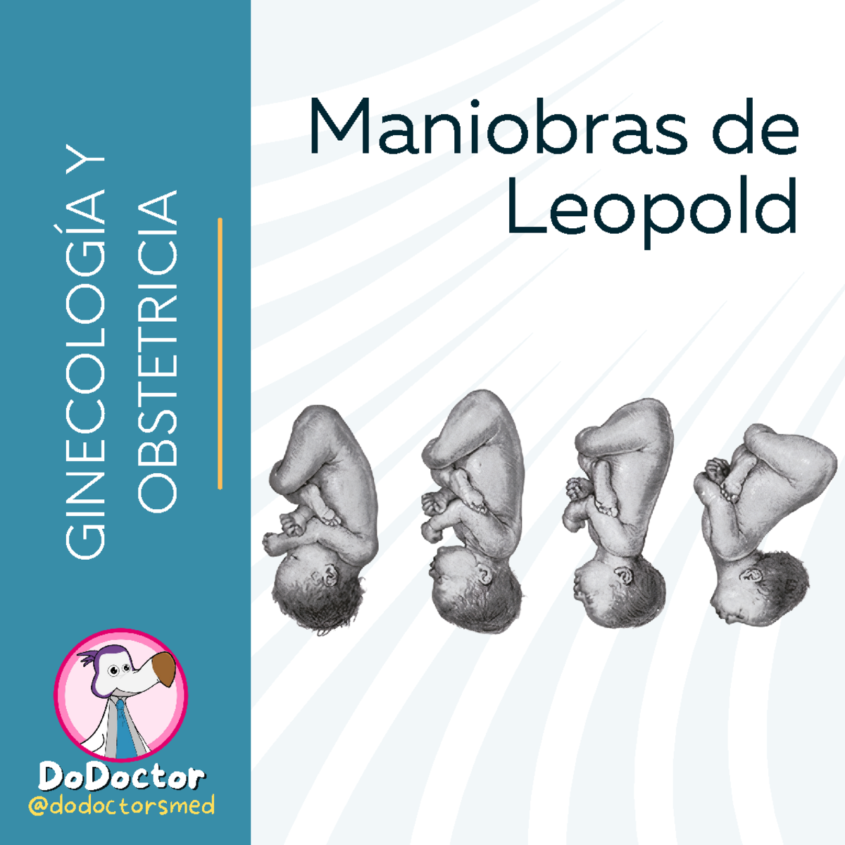 Maniobras DE Leopold - GINECOLOGÍA Y OBSTETRICIA Maniobras de Leopold ...