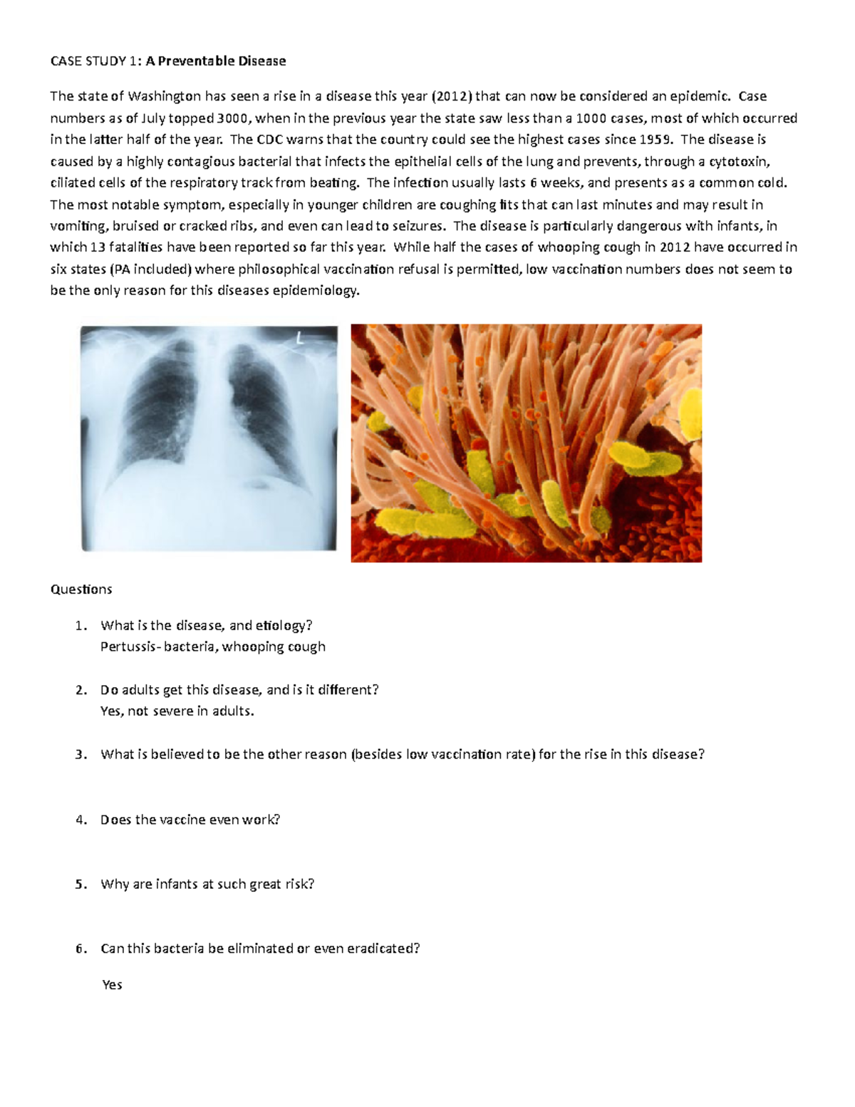 Respiratory - Andrew Brader - BIO 185 - Studocu