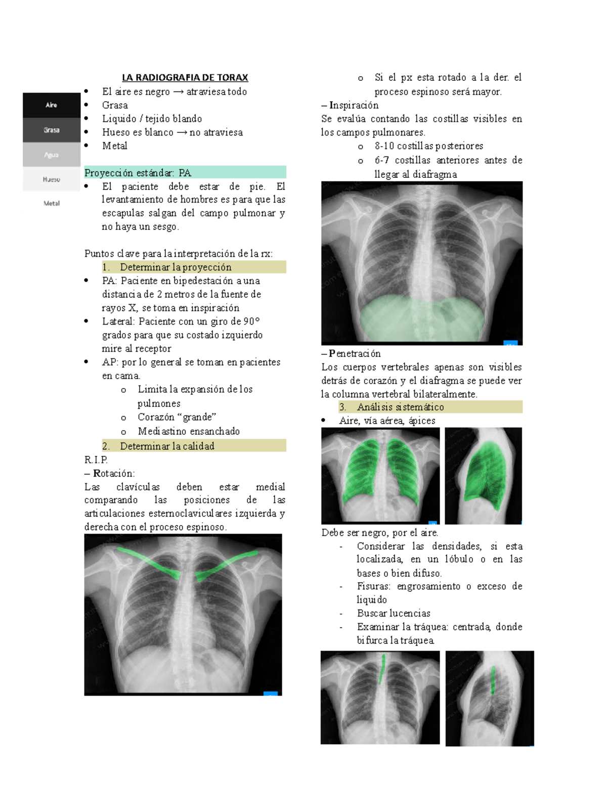 Leer una placa de torax - LA RADIOGRAFIA DE TORAX El aire es negro → ...