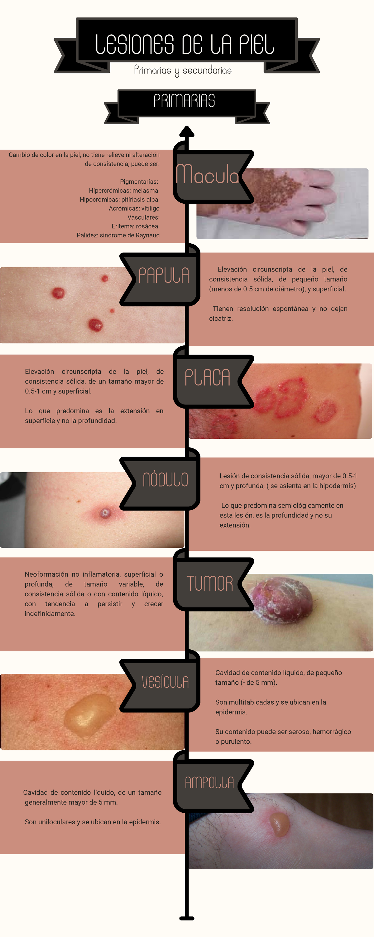 Lesiones de la piel - laksndlkasnc - LESIONES DE LA PIEL Macula PLACA ...