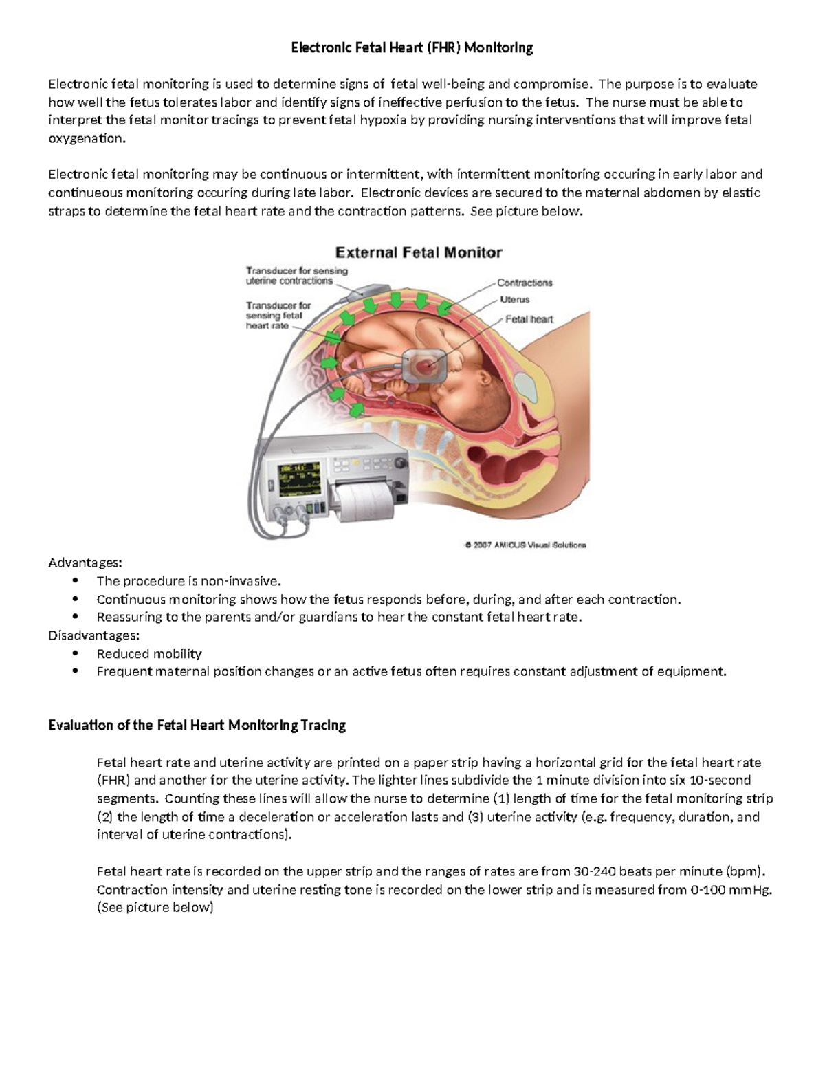 NR327 Fetal Monitoring Handout NA Wk 2 or 3 - Electronic Fetal Heart ...