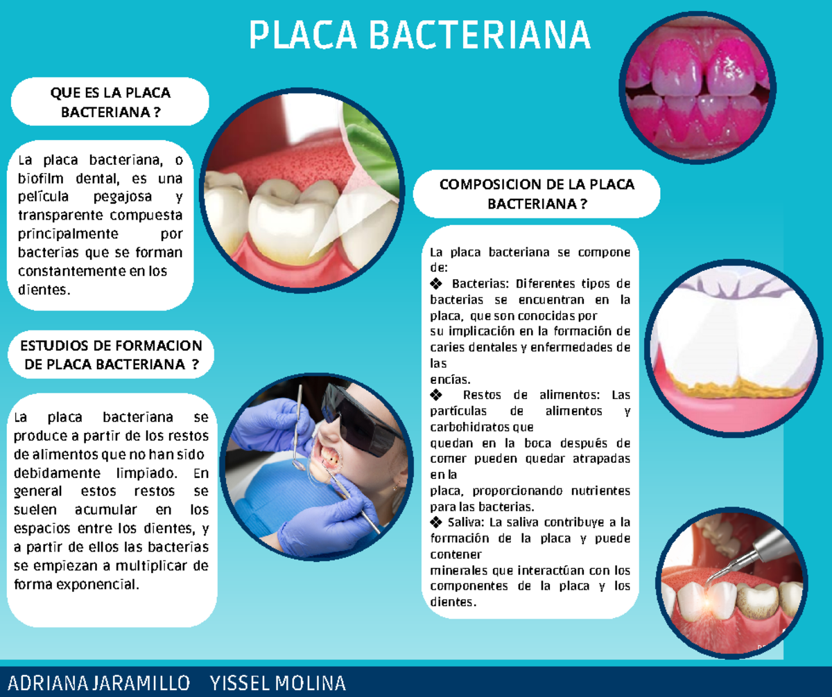 Infografia pdf - QUE ES LA PLACA BACTERIANA? COMPOSICION DE LA PLACA BACTERIANA? ESTUDIOS DE ...