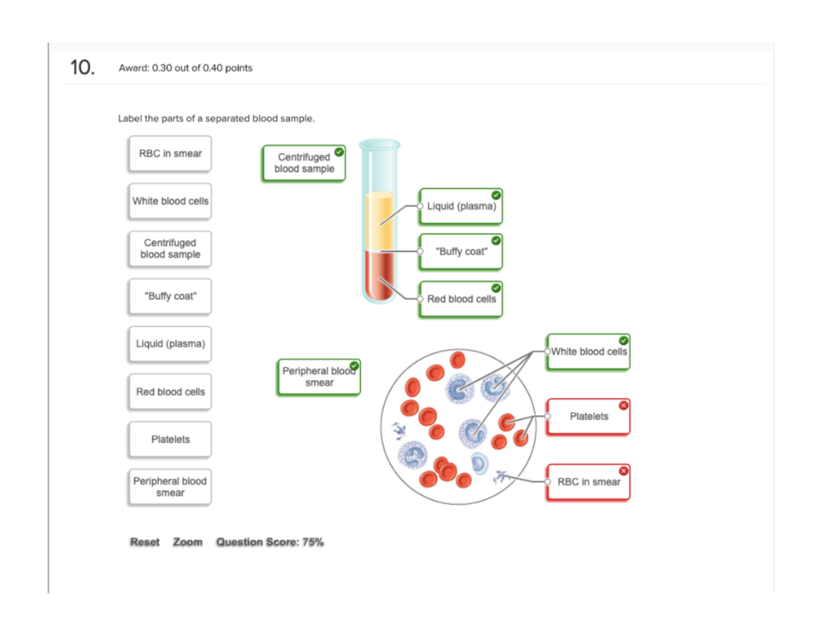 Module 2 Cardiovascular Blood Test & Typing - 10. Award: 0 out of 0 ...