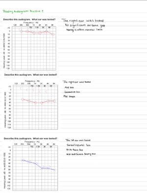 Vestibular Anatomy Cheatsheet - SPPA 231 - Studocu