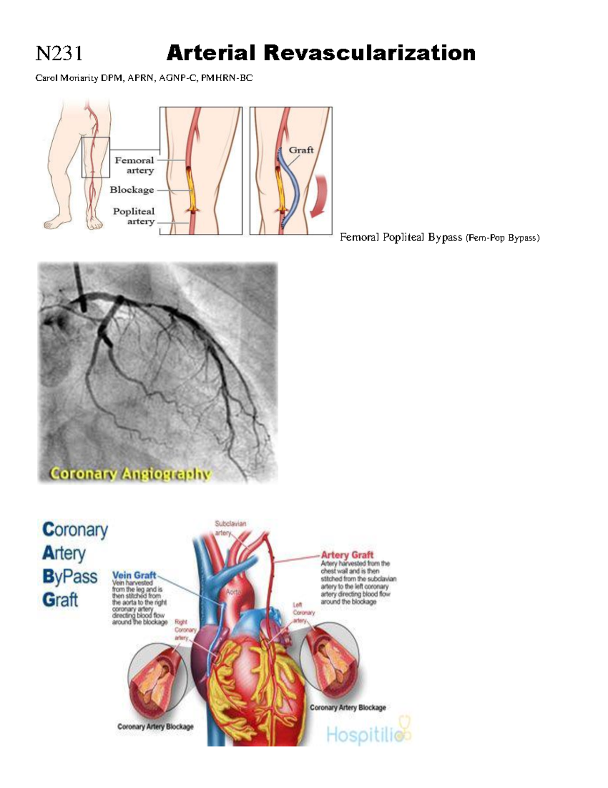 Arterial Revascularization - N231 Arterial Revascularization Carol ...
