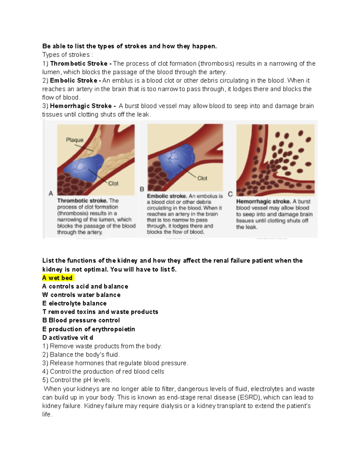 314 final study guide - Be able to list the types of strokes and how ...