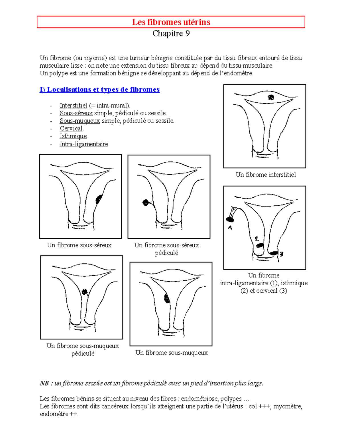 Ch09 Fibromes uterins - Gynecologie-Obstetrique - Les fibromes utérins ...