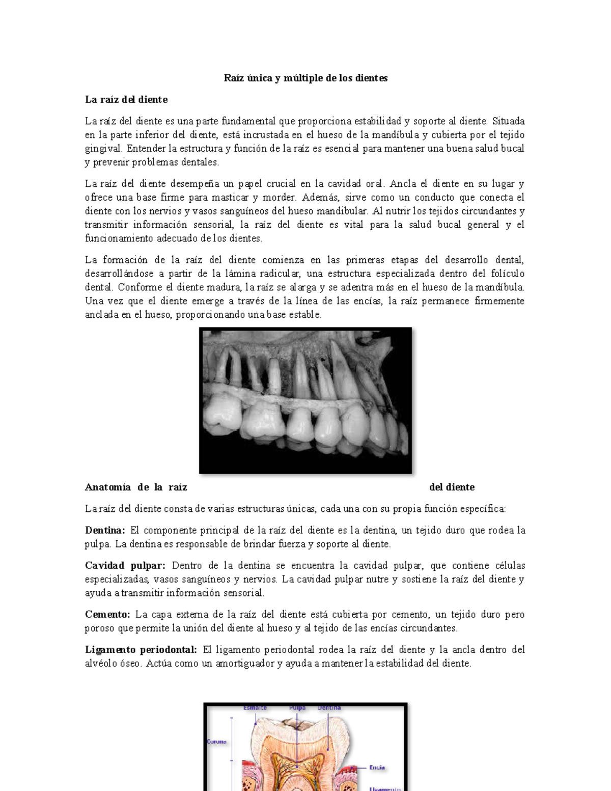 Raíz única y múltiple de los dientes - Raíz única y múltiple de los ...