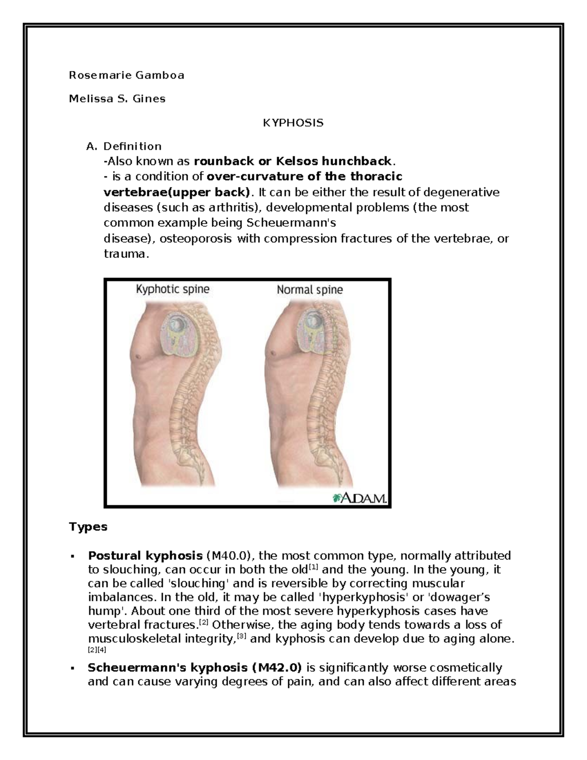 106056350-kyphosis - THis is helpful - Rosemarie Gamboa Melissa S ...