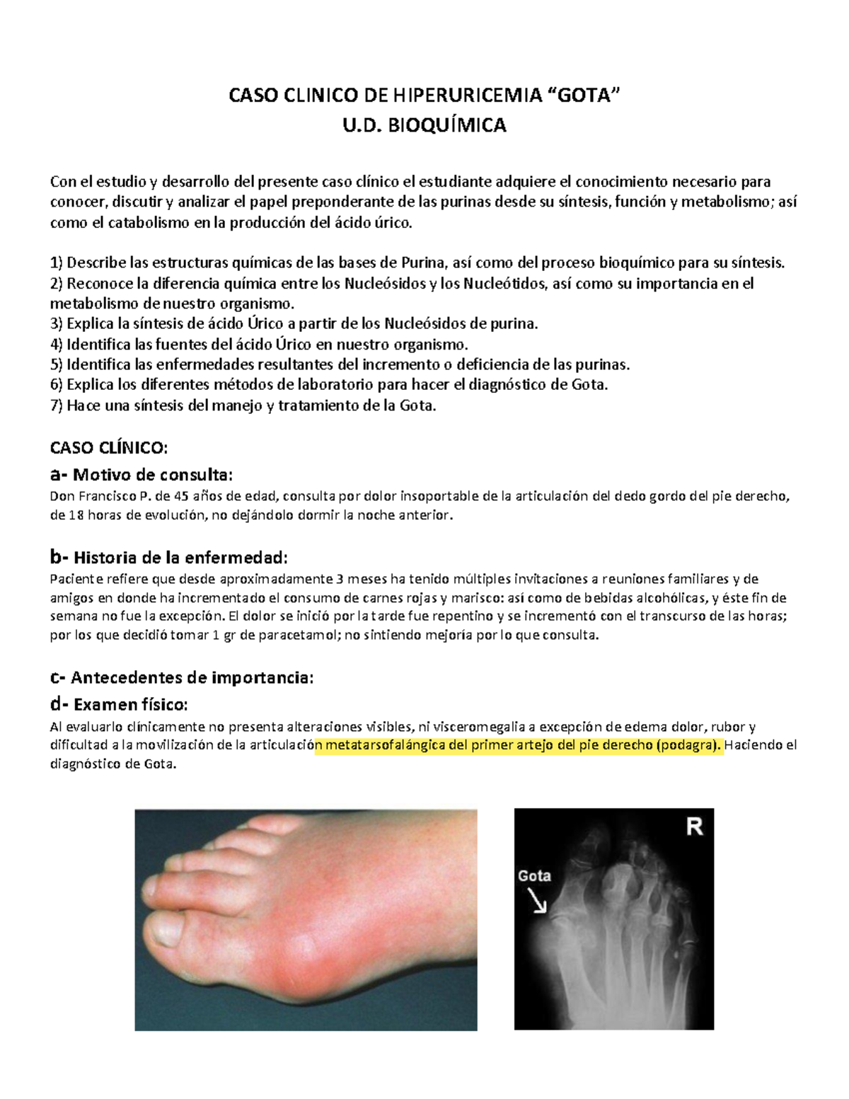 UDV CASO Clinico DE Hiperuricemia - CASO CLINICO DE HIPERURICEMIA “GOTA ...